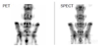 小动物活体成像系统 SPECT/PET/CT-托摩根生物科技有限公司