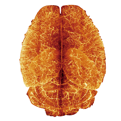 透明化,荧光标记,组织成像,图像分析服务_参数_价格-仪器信息网