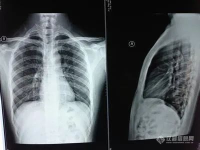 XRM原理知识——用好CT的必备知识_布鲁克衍射荧光事业部(Bruker AXS)