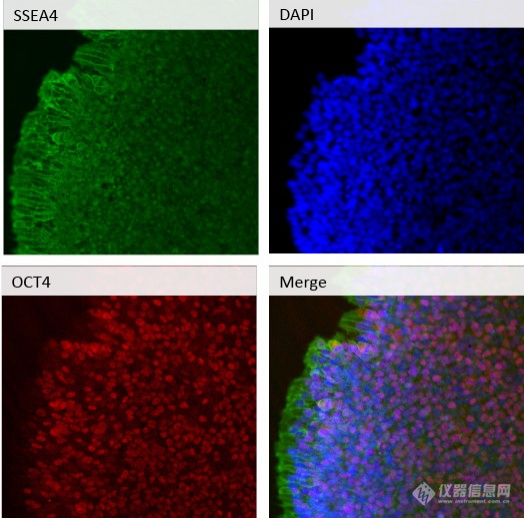Matriclone实验篇--联合VIPS PRO助力单细胞铺板！_安达望（Advanced Instruments）