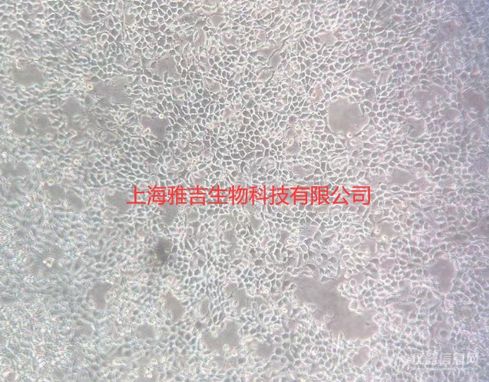 HUVEC+GFP 人脐静脉内皮细胞永生化+GFP_上海雅吉生物科技有限公司