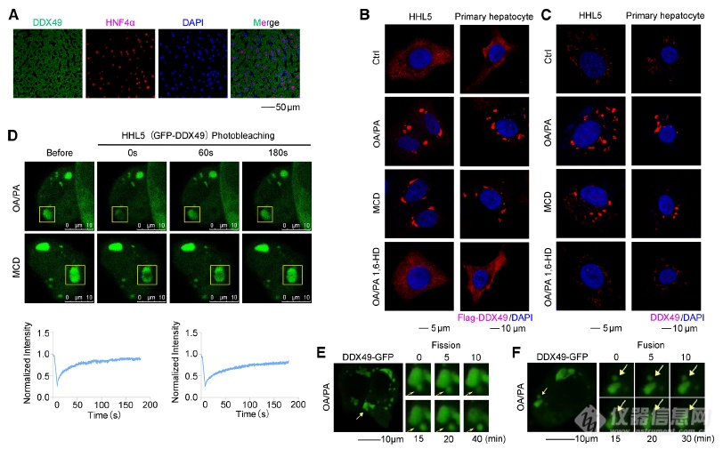 【创新发现】Sony SH800助力发现新型脂质诱导颗粒，重塑肝纤维化发生进展_索尼生命科学